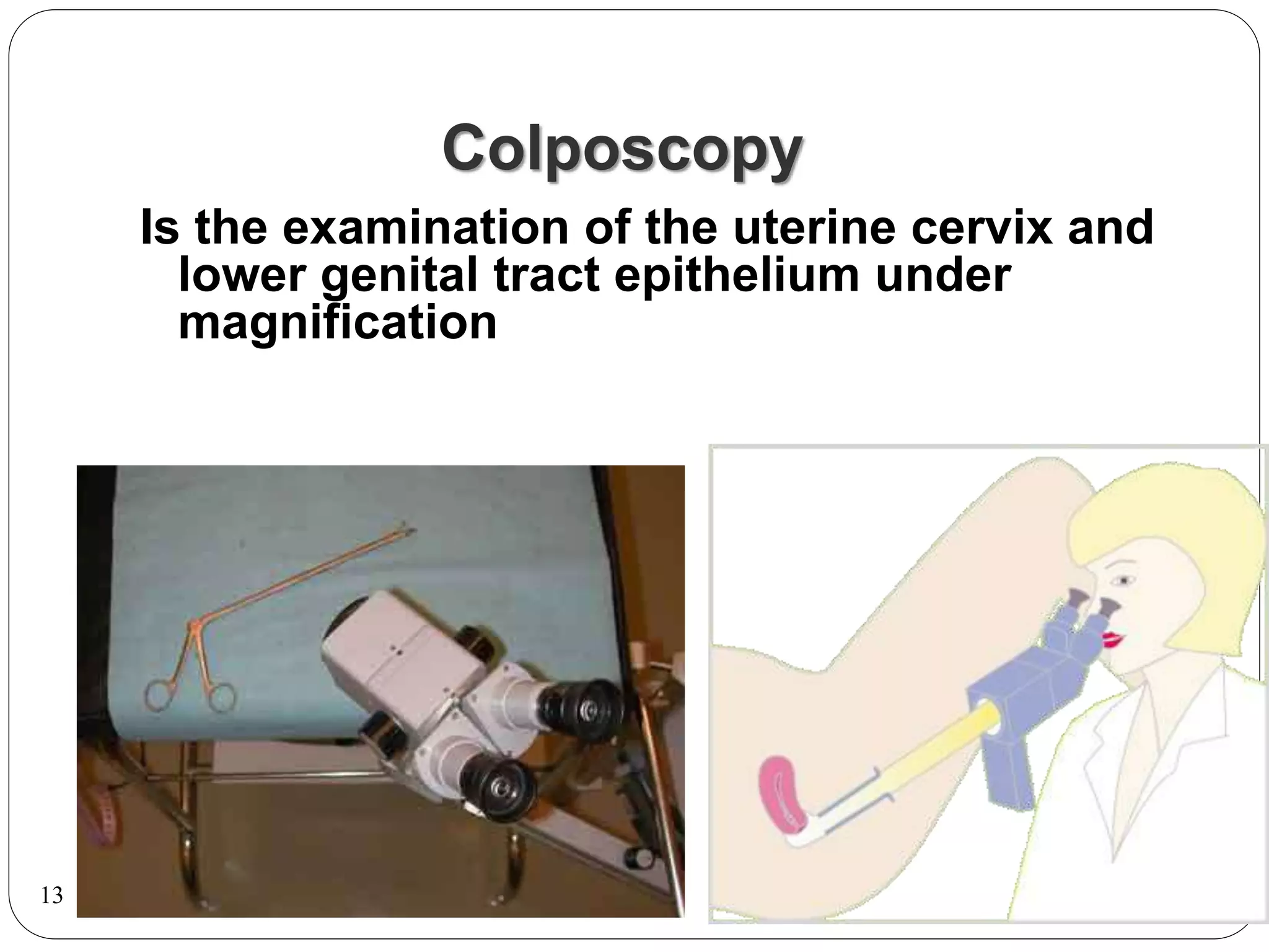 Premalignant And Malignant Conditions Of The Cervix Ppt