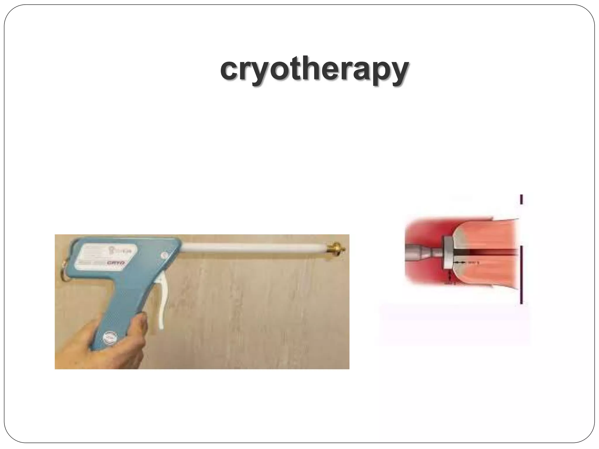 Premalignant and malignant conditions of the cervix | PPTX