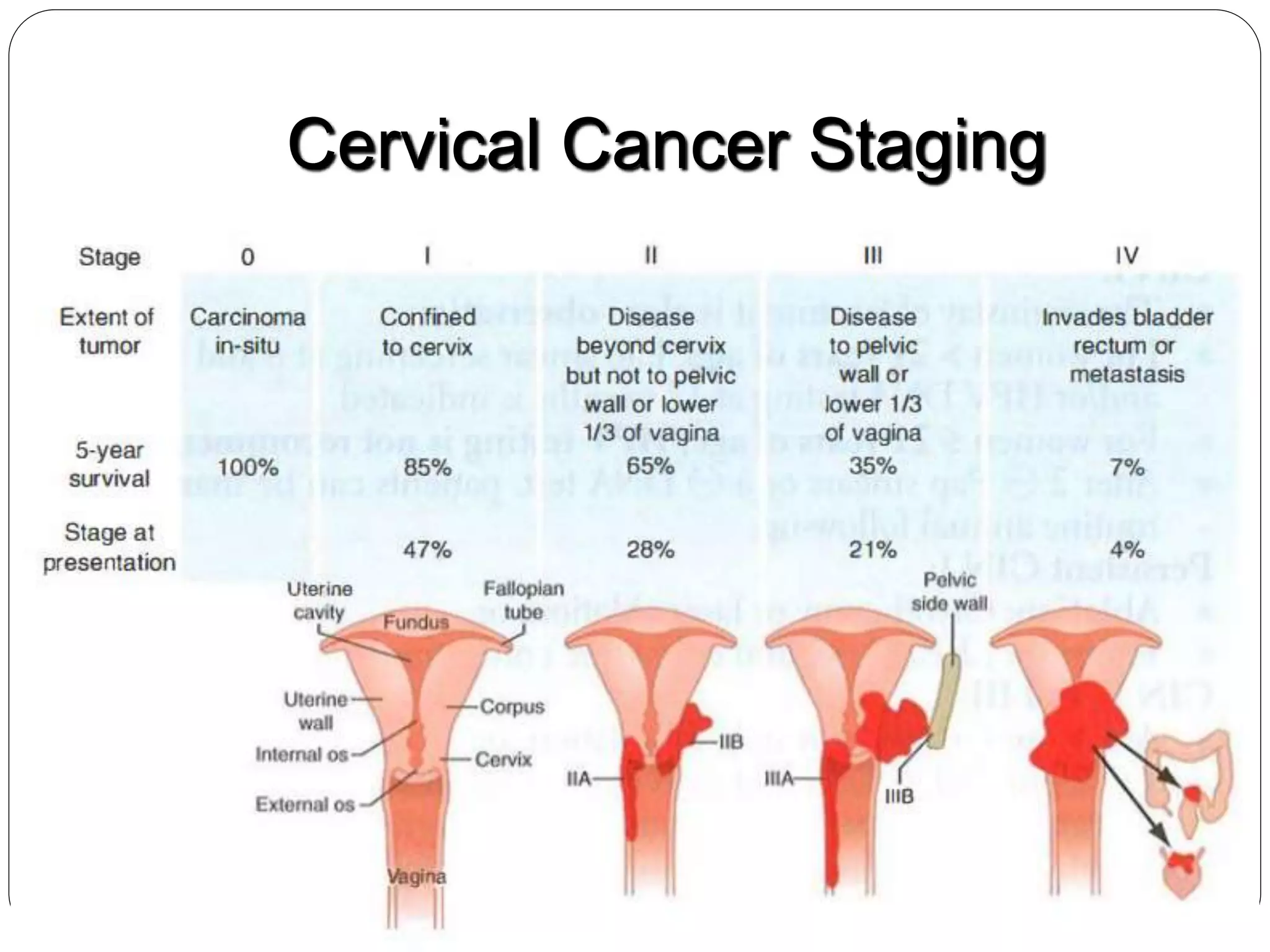 Premalignant and malignant conditions of the cervix | PPTX | Cancer ...