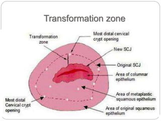 Premalignant and malignant conditions of the cervix | PPTX