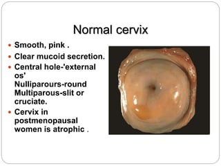 Premalignant and malignant conditions of the cervix | PPT