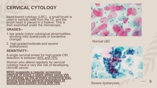 PREMALIGNANT AND MALIGNANT DISEASE OF CERVIX (1).pptx