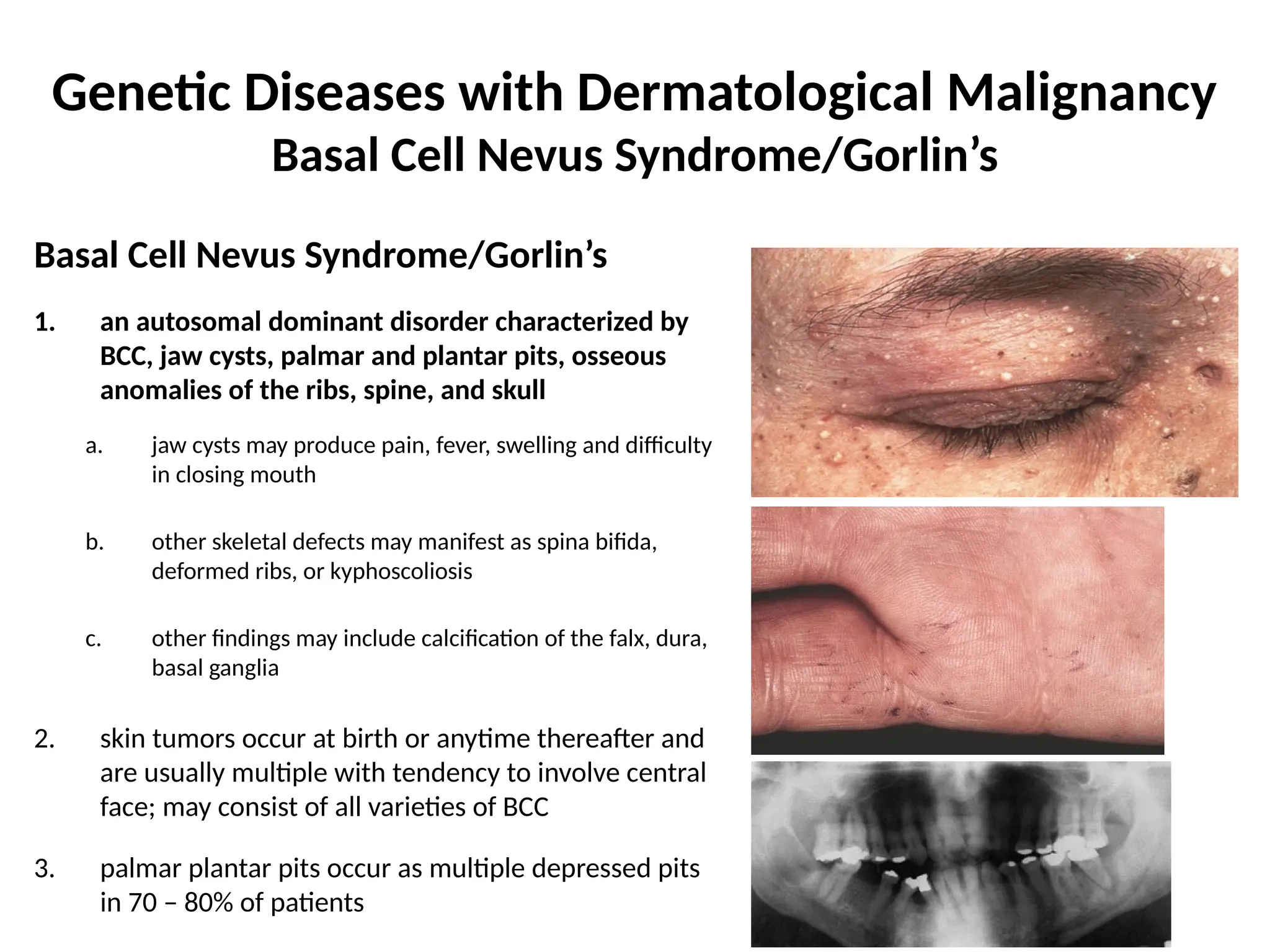 Premalignant and Malignant Skin Lesions & Disorders_Mari-Alina ...