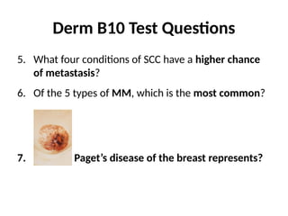 Premalignant and Malignant Skin Lesions & Disorders_Mari-Alina ...