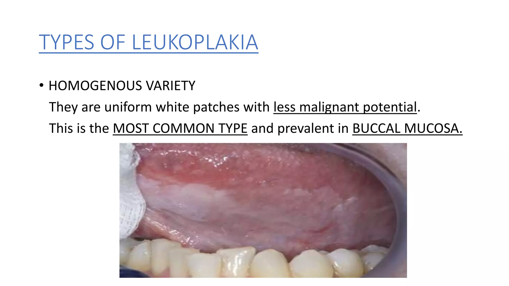 Premalignant conditions of oral cavity | PPTX