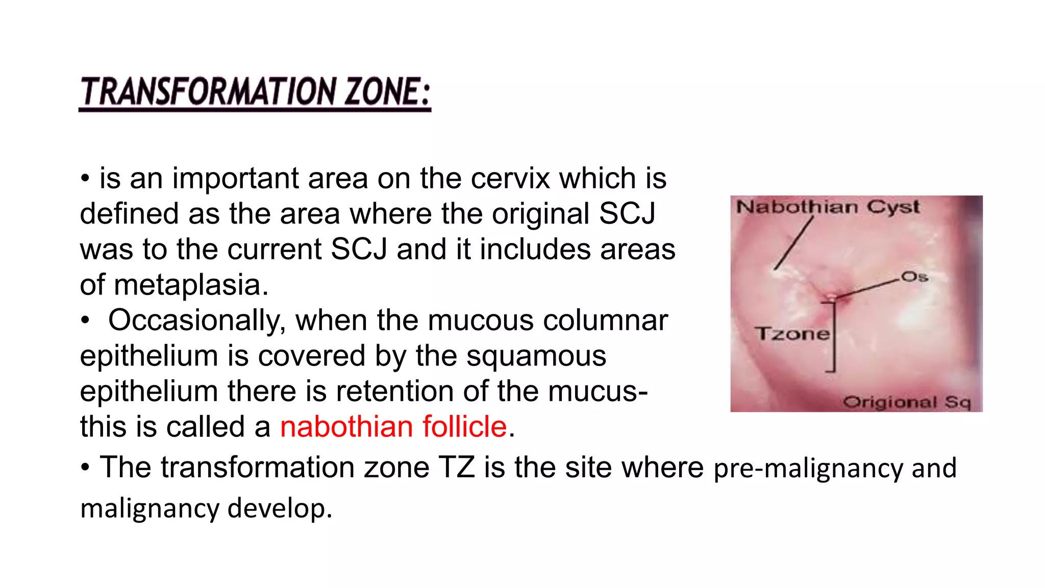 Premalignant diseases of the cervix | PPTX