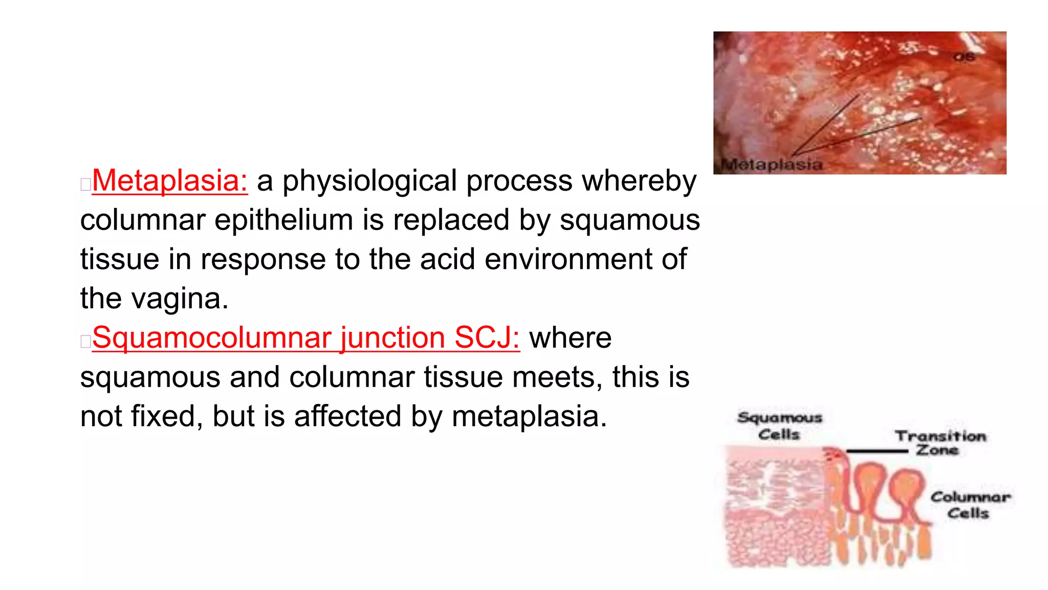 Premalignant diseases of the cervix | PPTX