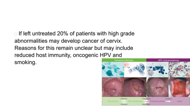 Premalignant Diseases Of The Cervix