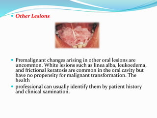 Premalignant lesion | PPTX