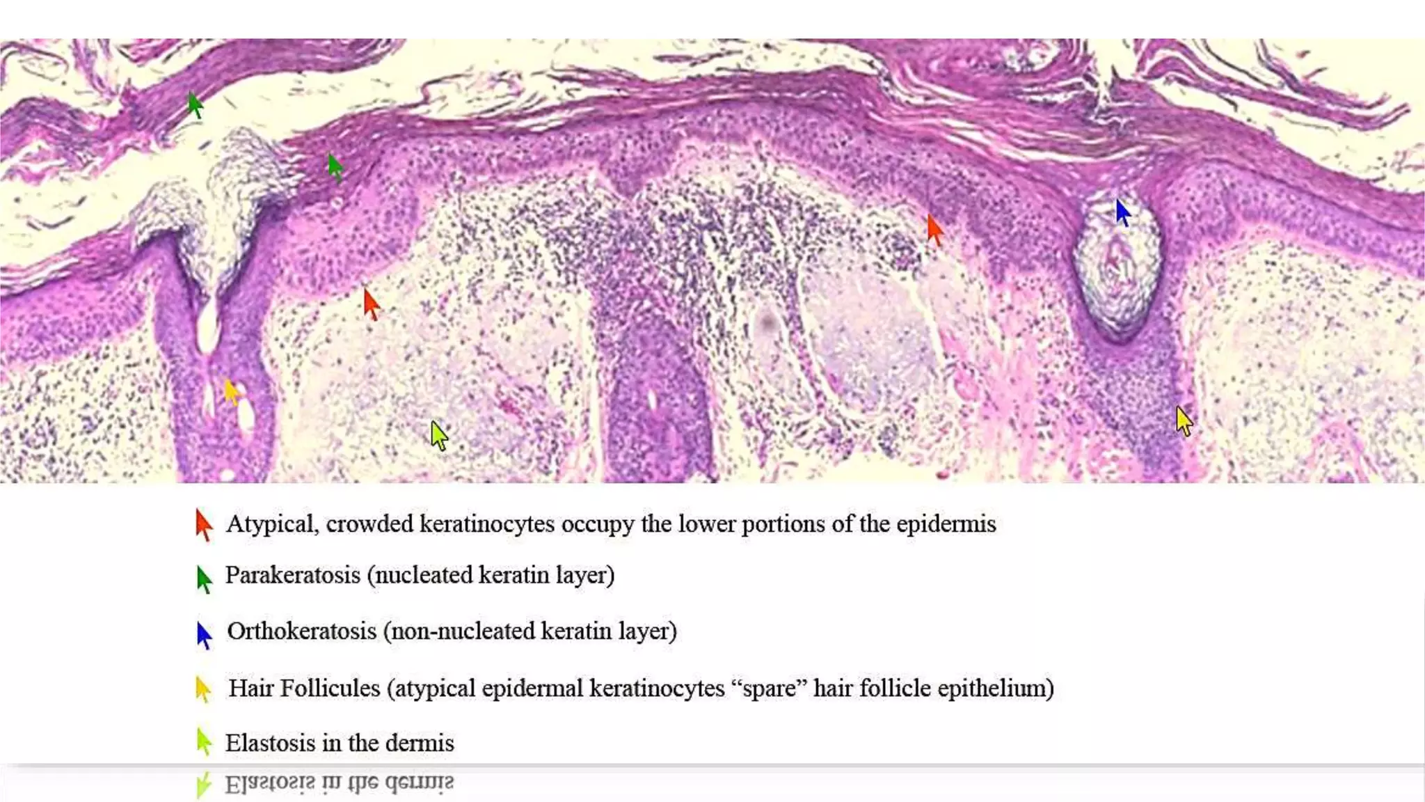 Premalignant Skin Conditions | PPTX