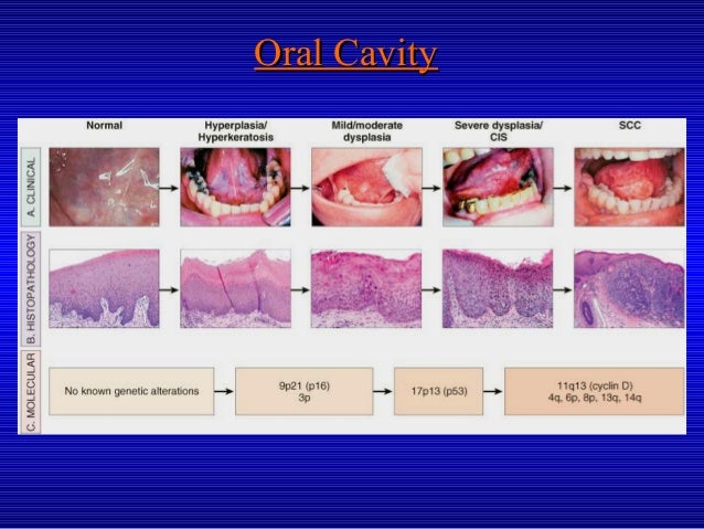 Premalignant lesions