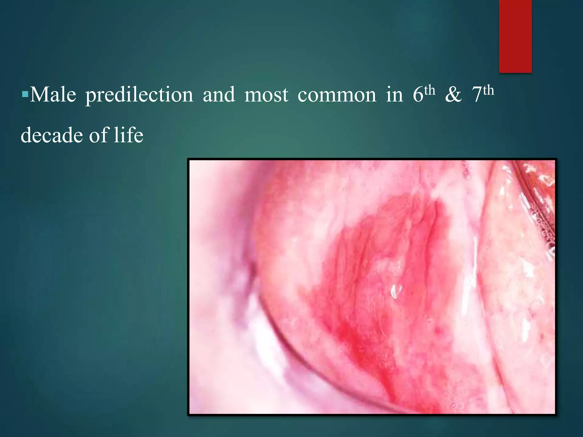 Premalignant lesions and conditions | PPTX