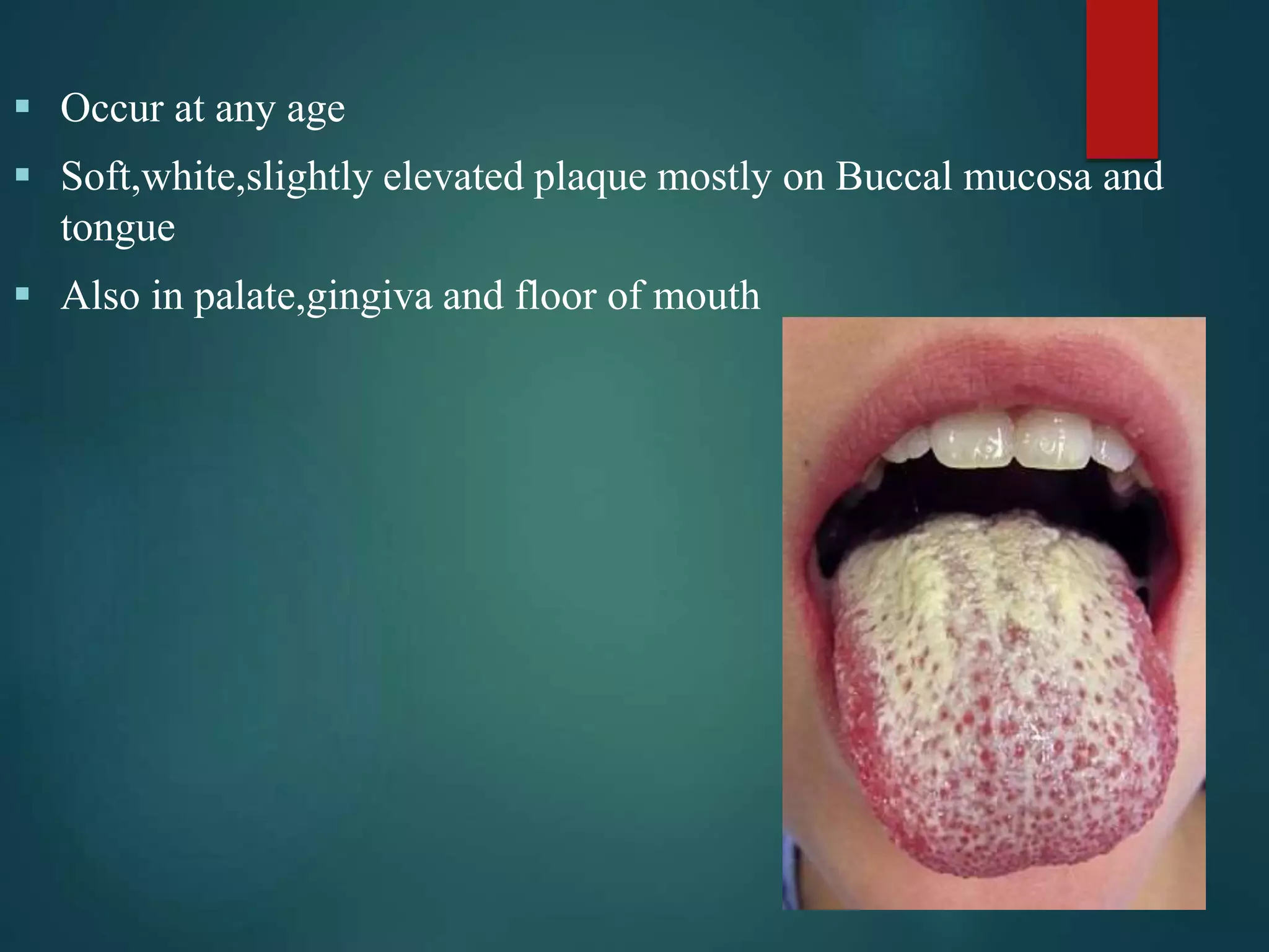 Premalignant lesions and conditions | PPTX