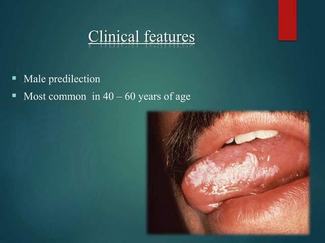 Premalignant lesions and conditions | PPTX