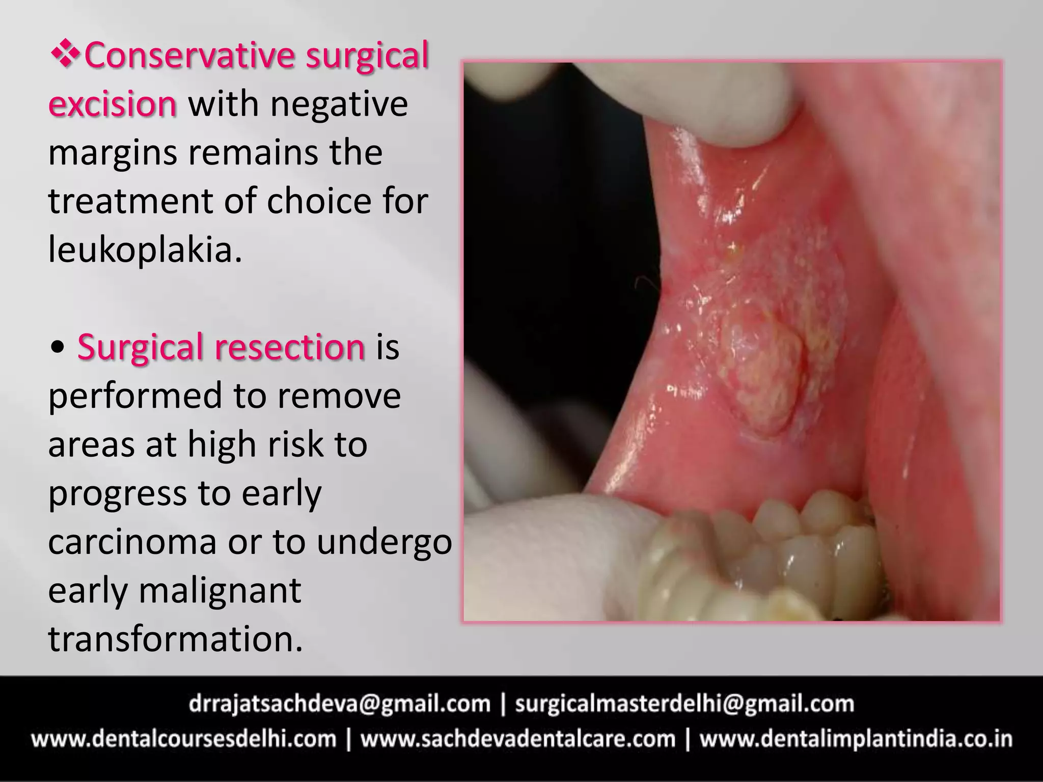 Pre malignant lesions and conditions | PPTX
