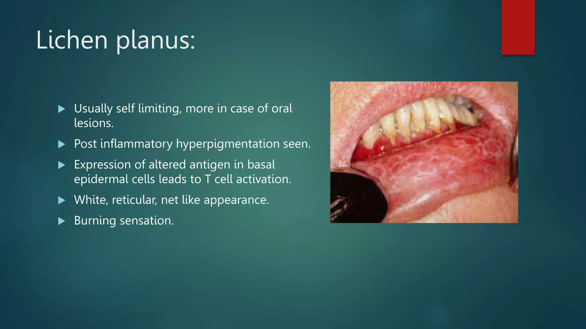 premalignant lesions new.pptx