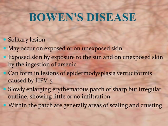 Pre malignant lesions of skin | PPTX