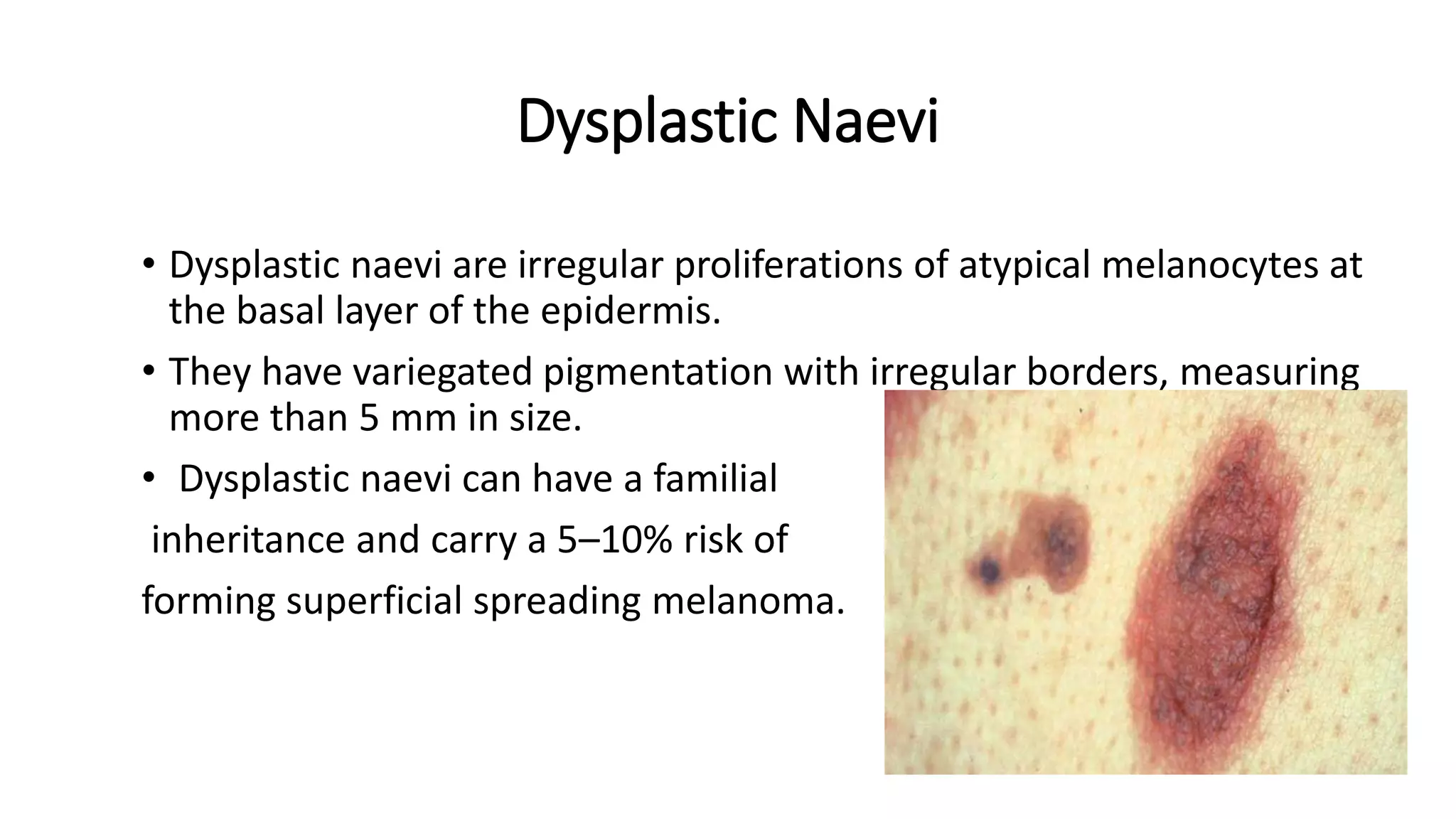 Premalignant lesions of skin | PPTX