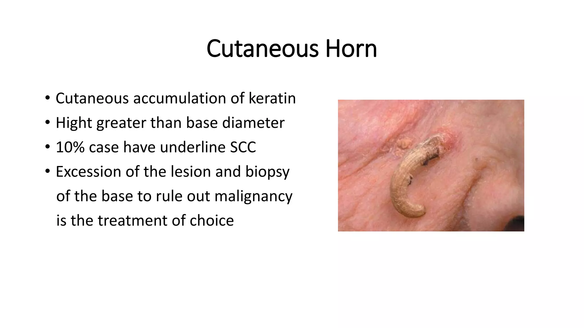Premalignant lesions of skin | PPTX
