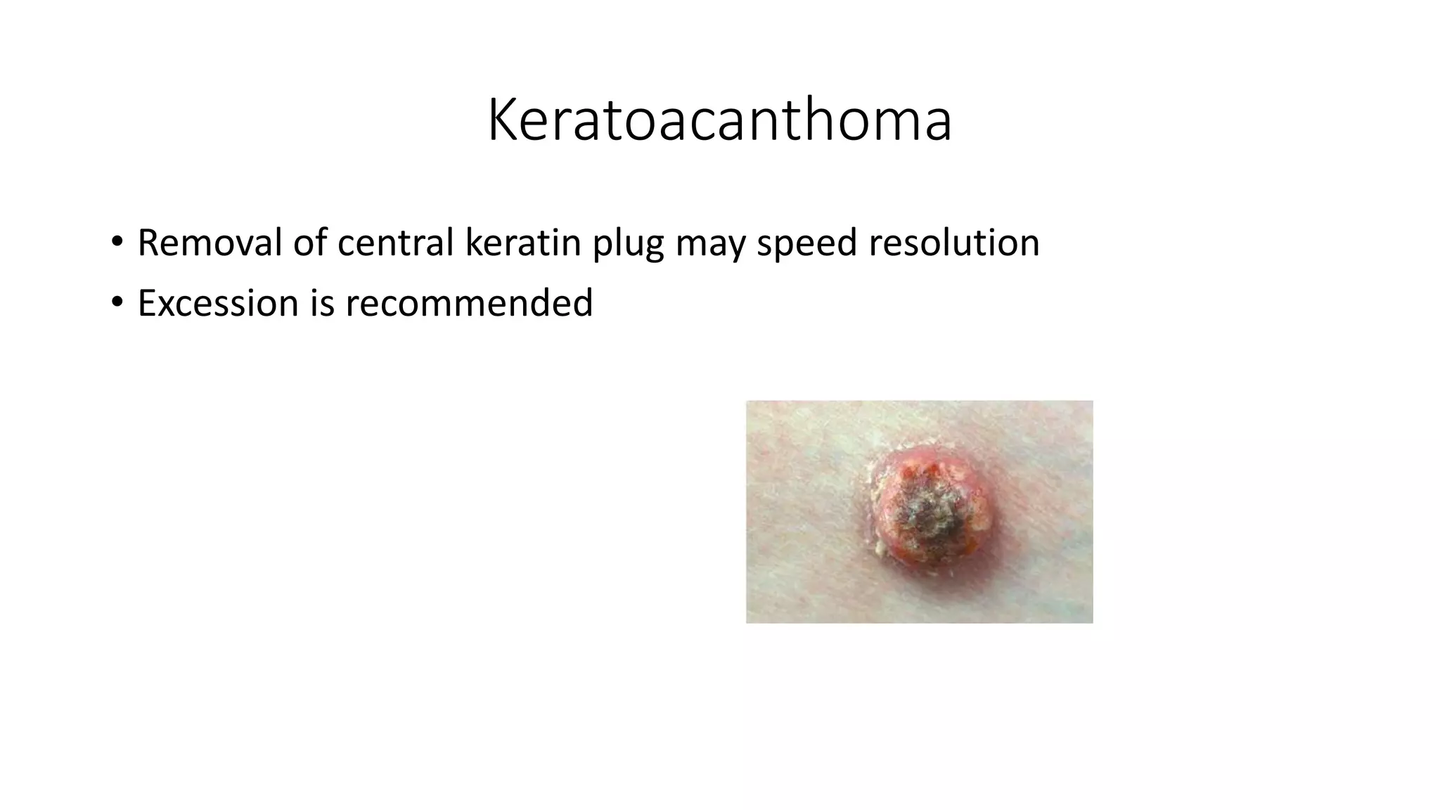 Premalignant lesions of skin | PPTX