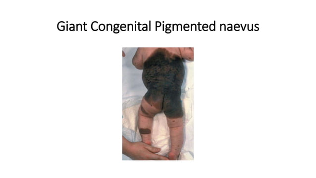 Premalignant lesions of skin | PPTX