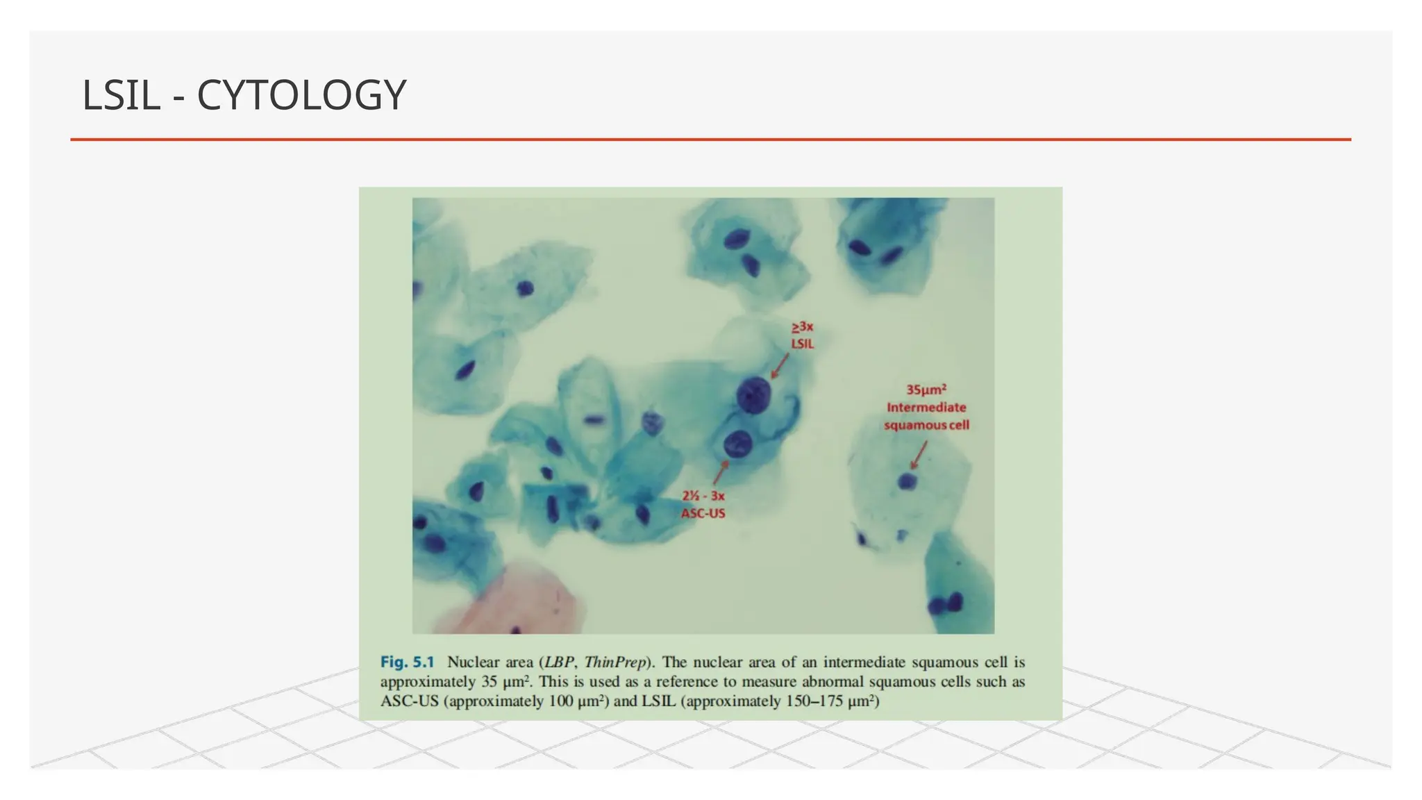Premalignant Lesions Of The Uterine Cervix Ppt Pptx