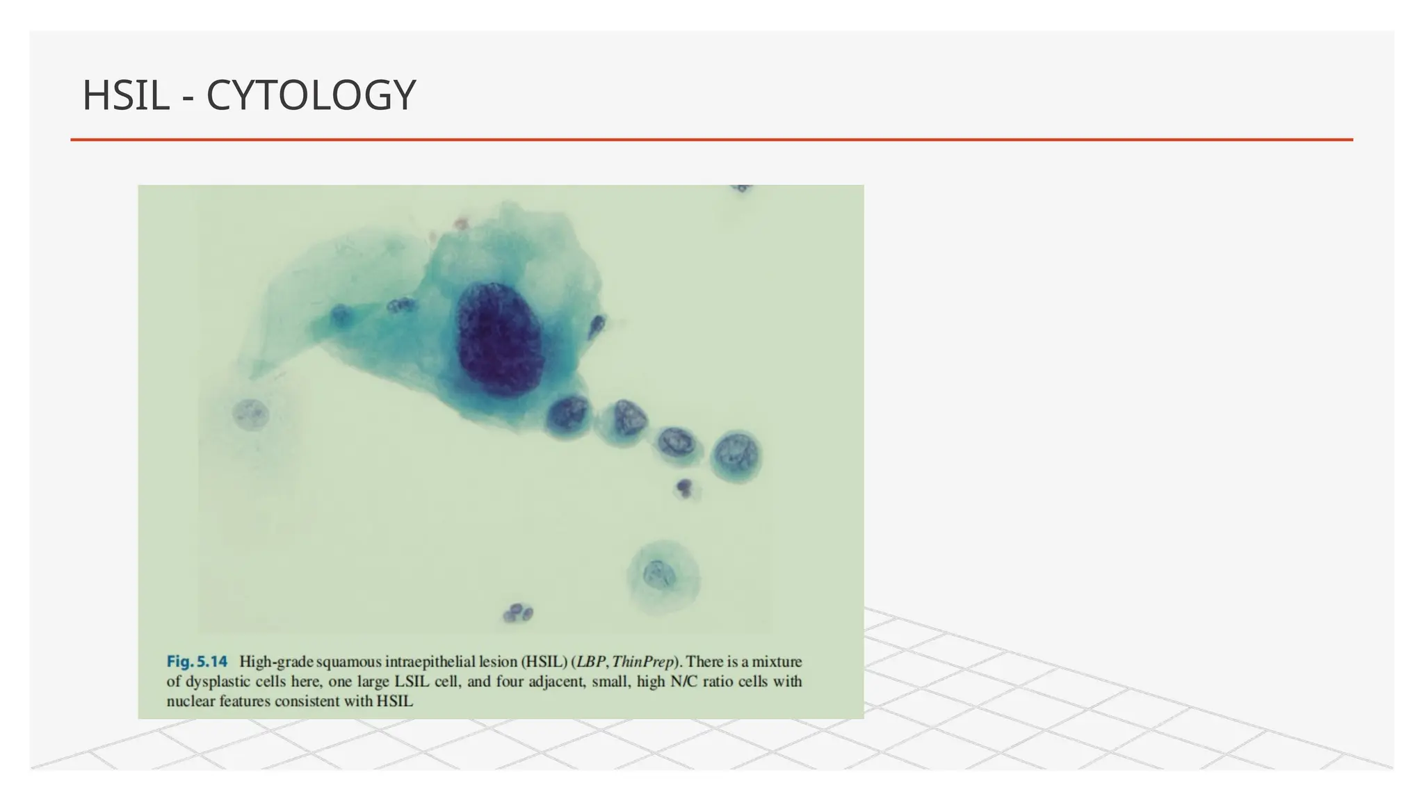 PREMALIGNANT LESIONS OF THE UTERINE CERVIX PPT.pptx
