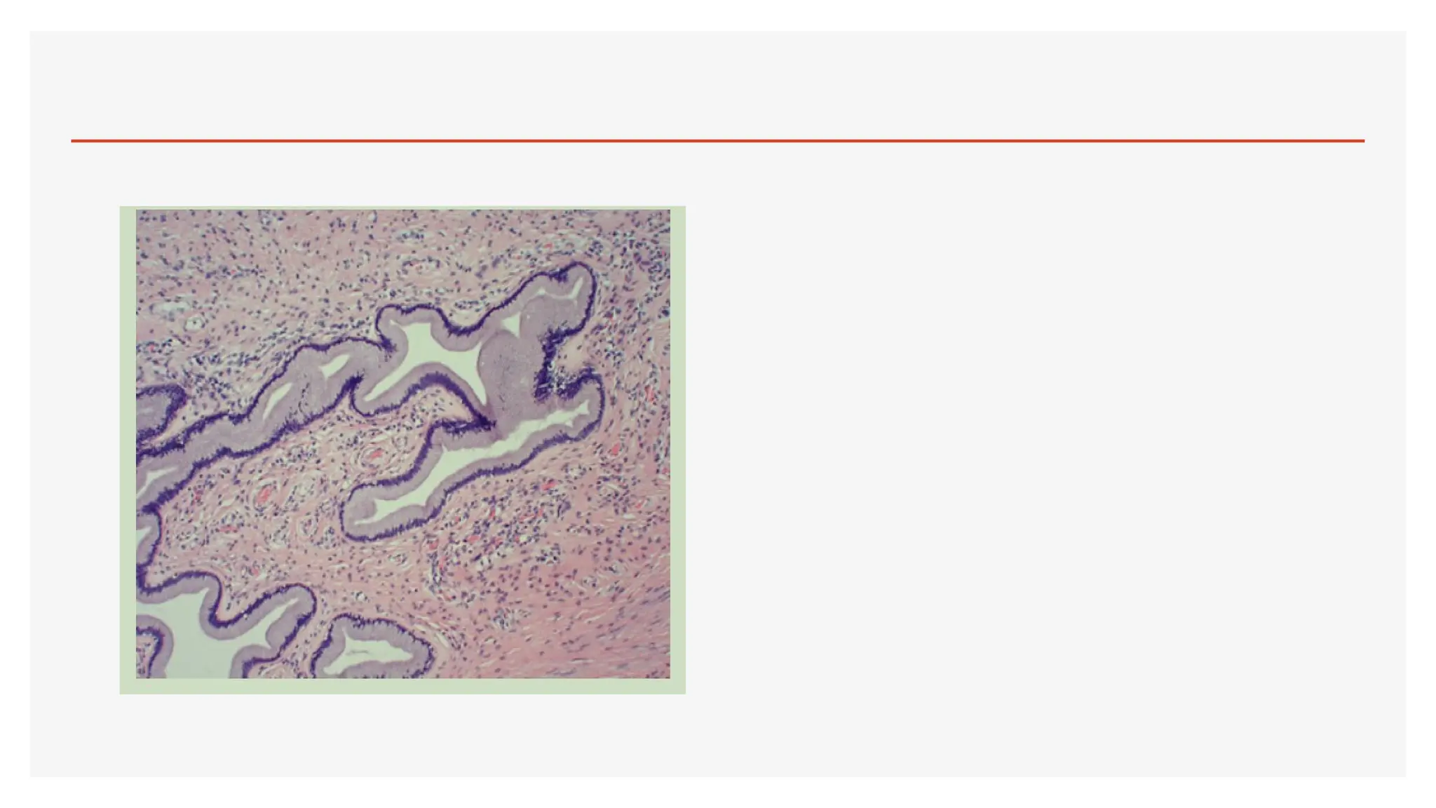 Premalignant Lesions Of The Uterine Cervix Ppt Pptx