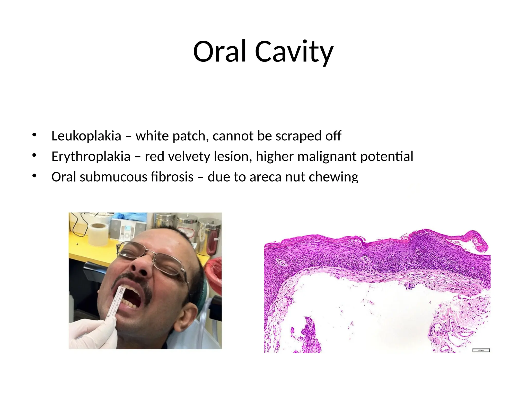 Premalignant(precancerous)_Lesions_Pathology.pptx