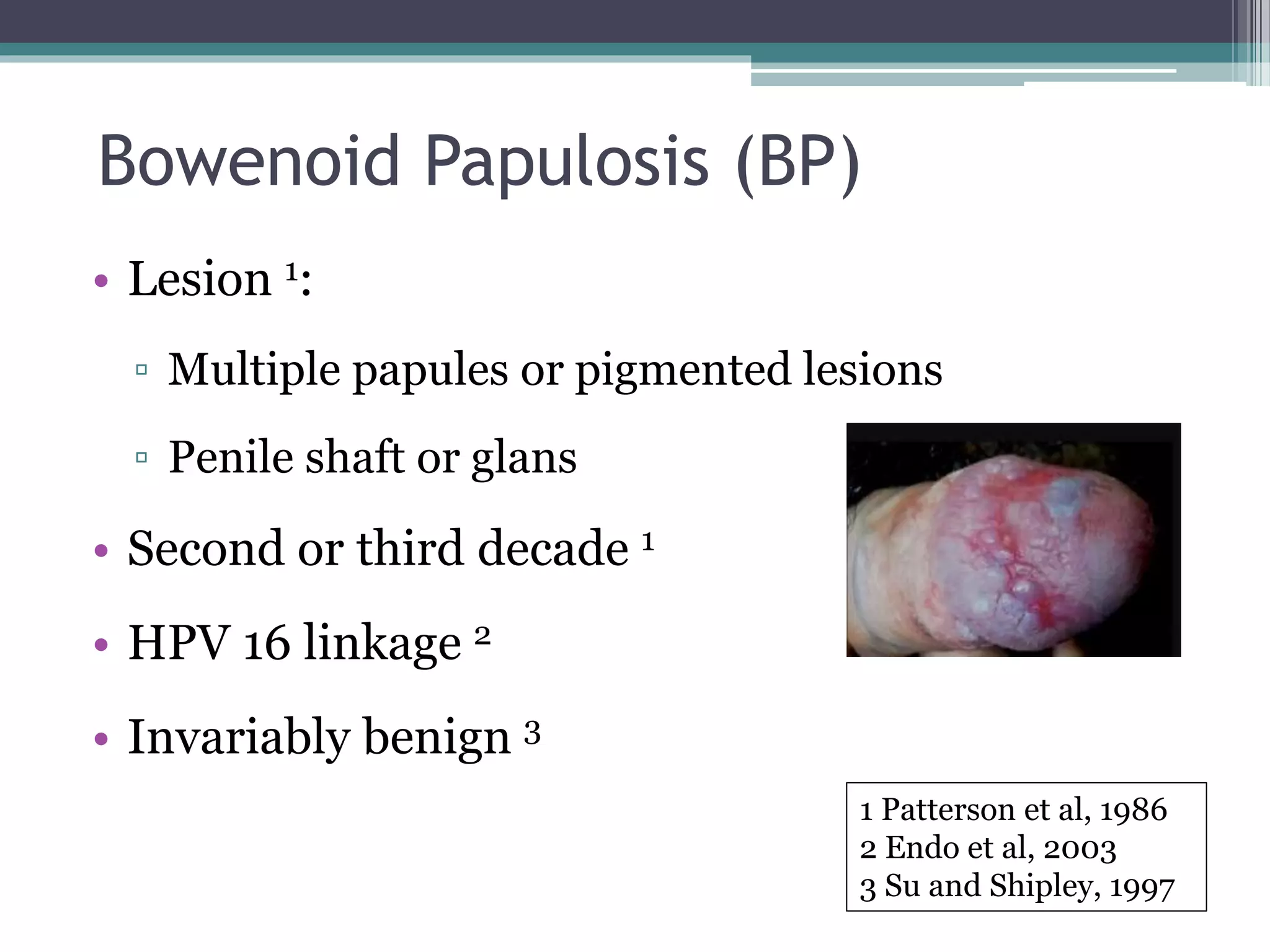 Premalignant penile lesions.pptx