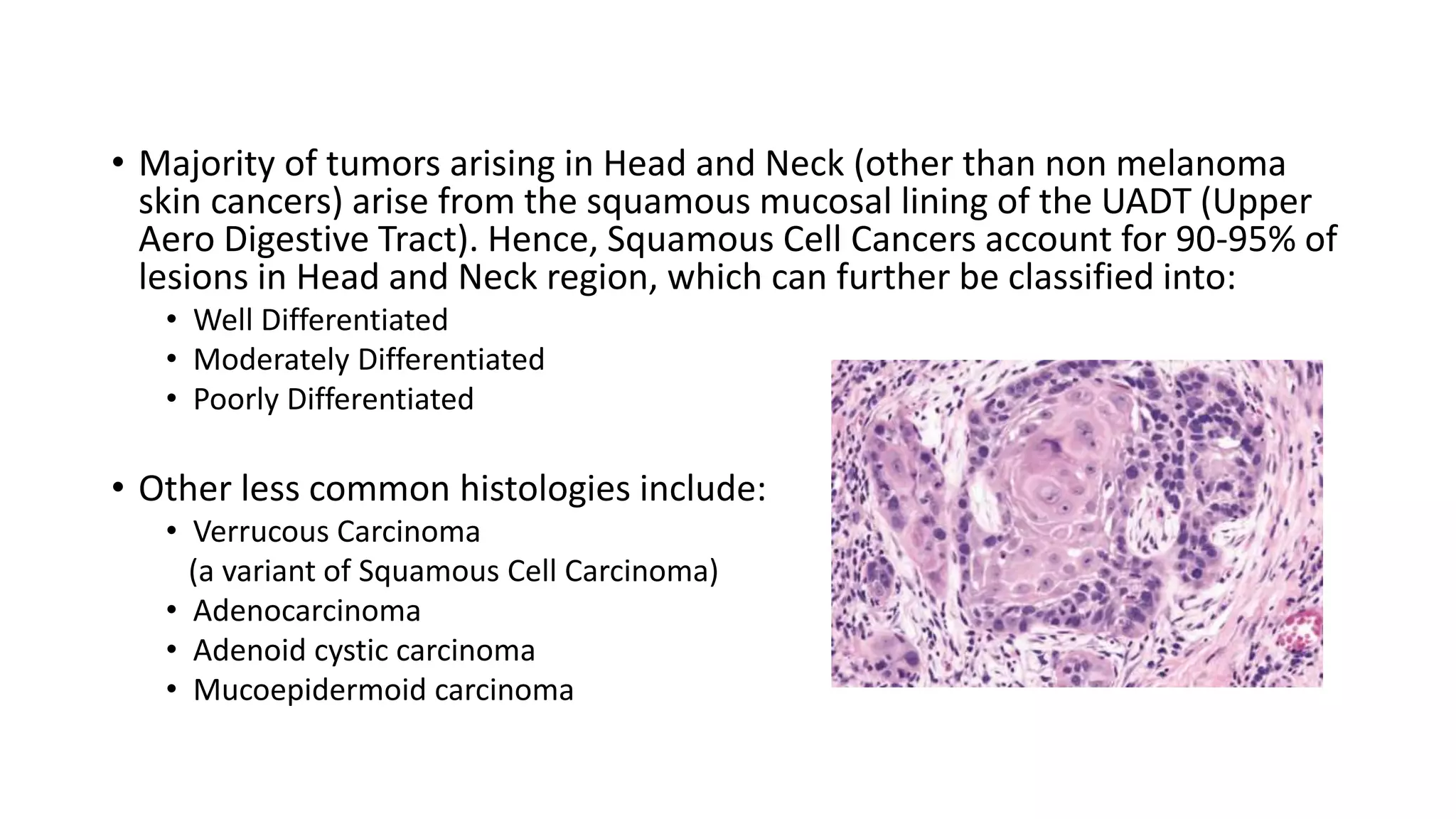 Pre management in Head and Neck Cancers.pptx