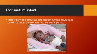 Premature baby | PPT