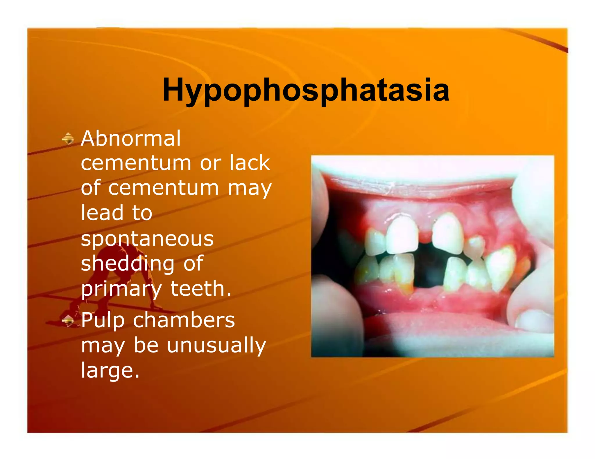 Premature exfoliation of primary teeth | PPTX