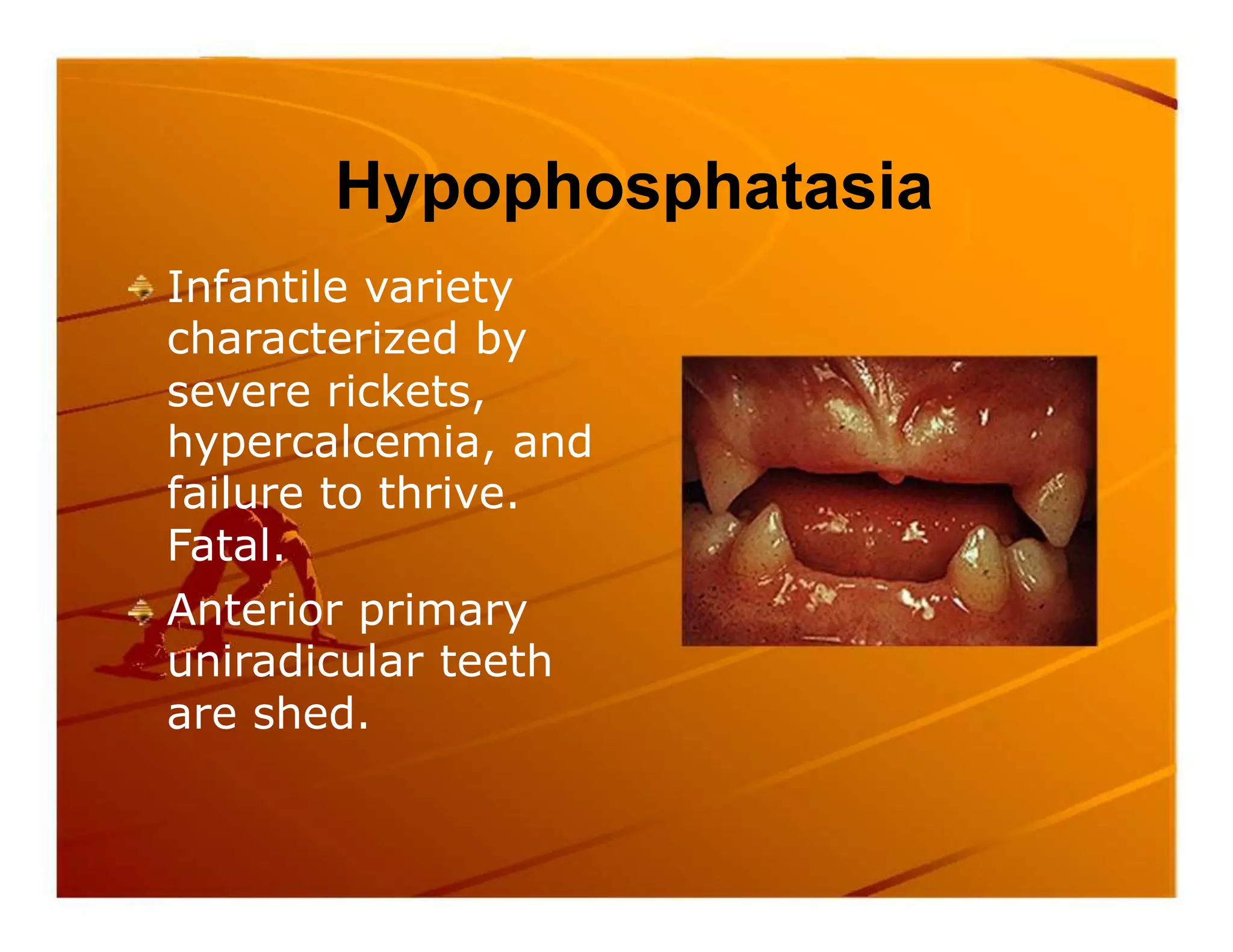 Premature exfoliation of primary teeth | PPT | Free Download