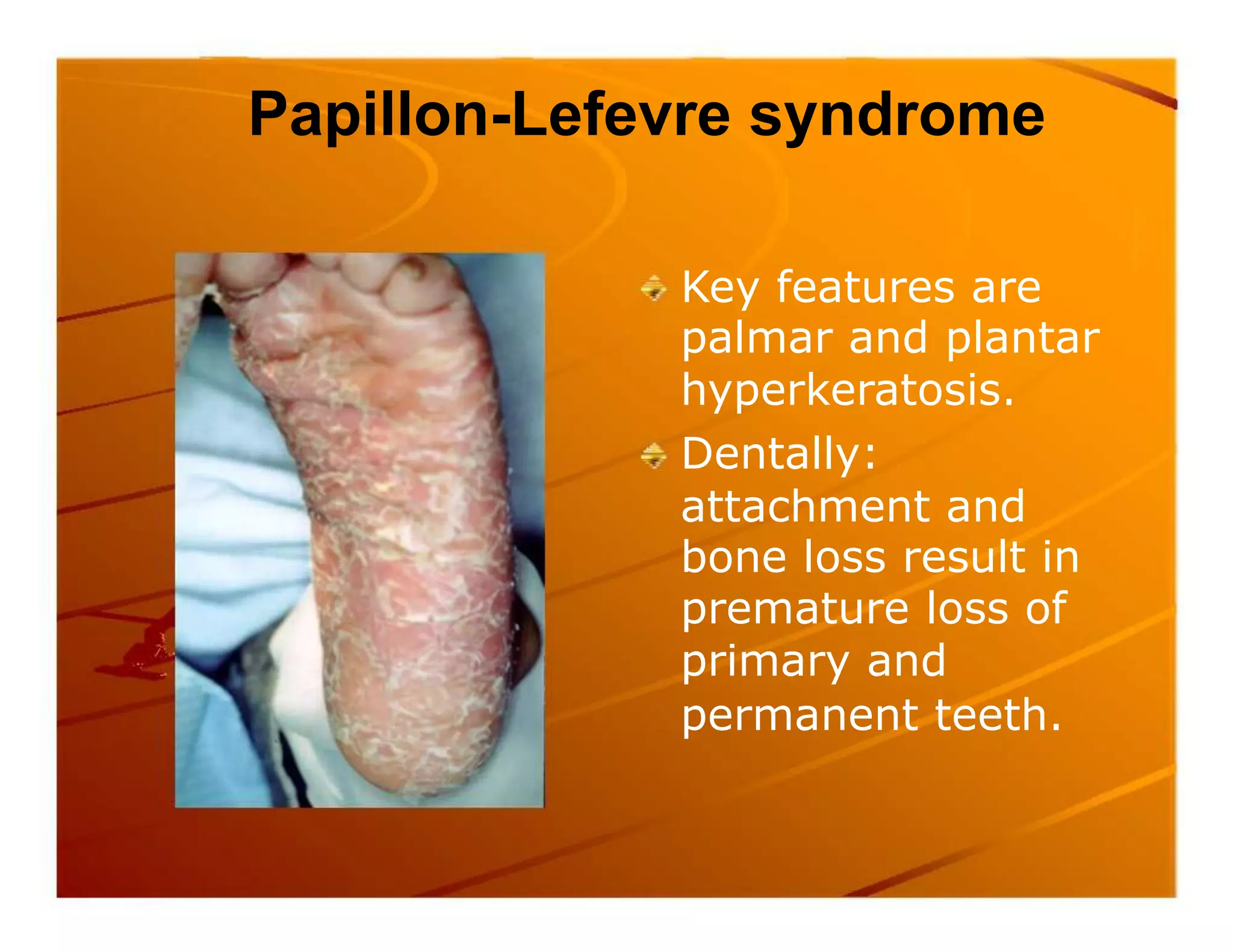 Premature exfoliation of primary teeth | PPTX