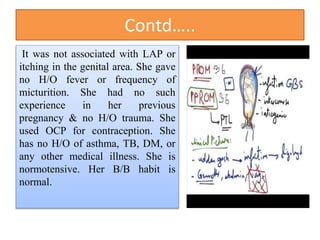 Premature rupture of membrane, case and Topic ll Dr.Jakia Akter | PPT