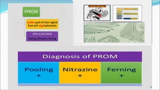 Premature rupture of membrane (PROM).pptx