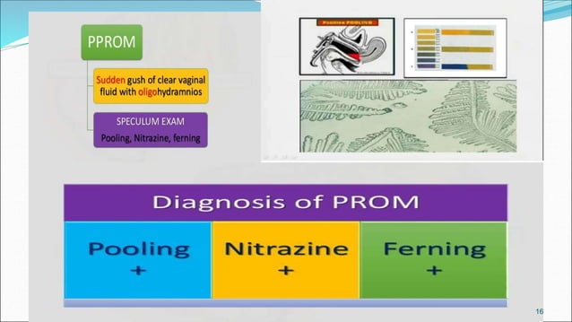 Premature rupture of membrane (PROM).pptx | Pregnancy | Reproductive Health