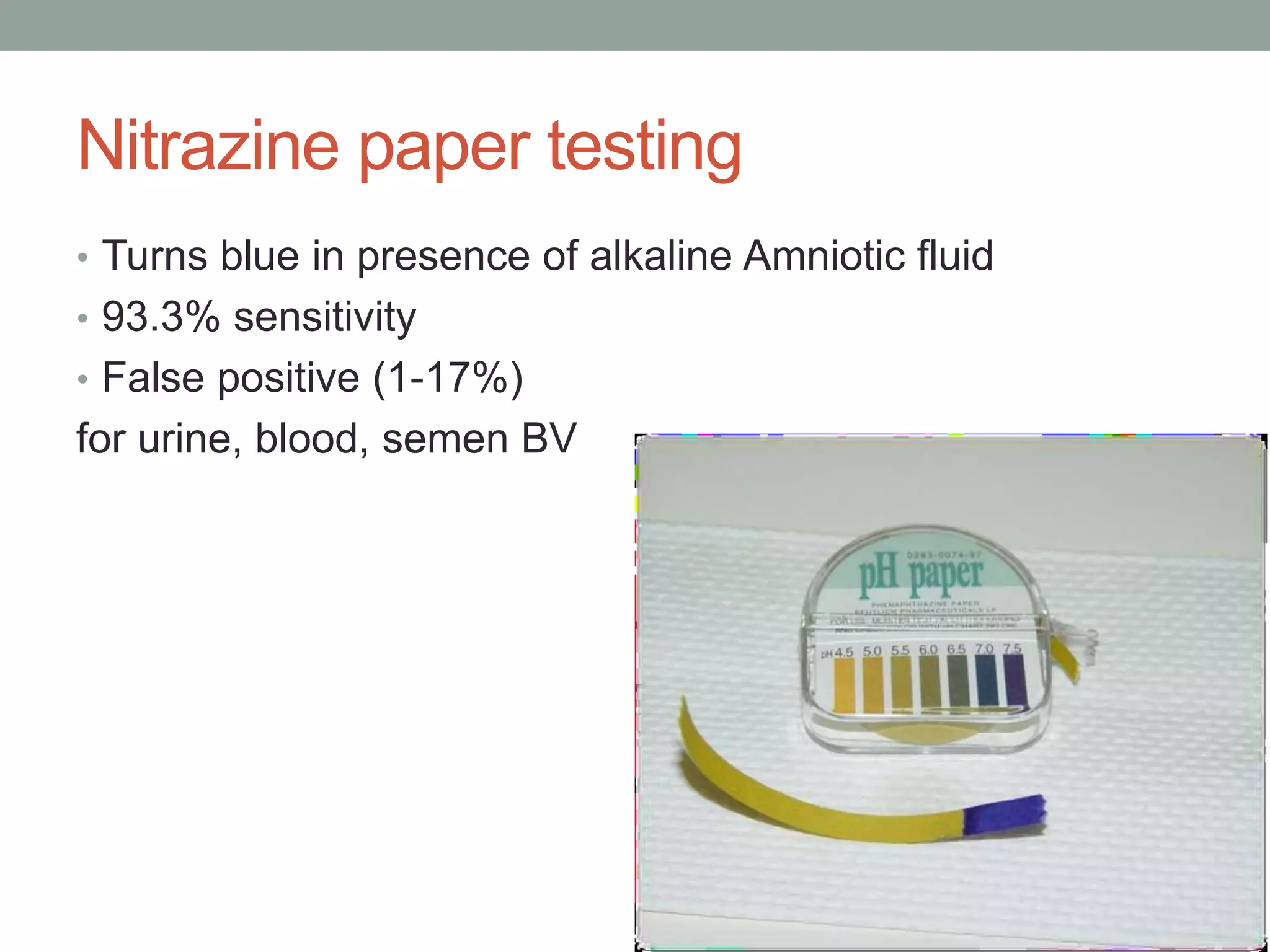 Premature rupture of membranes | PPTX