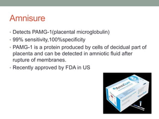 Premature rupture of membranes | PPTX