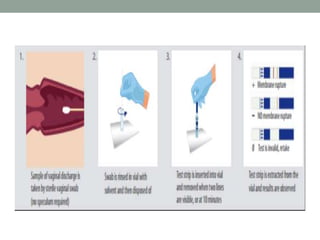 Premature rupture of membranes | PPTX
