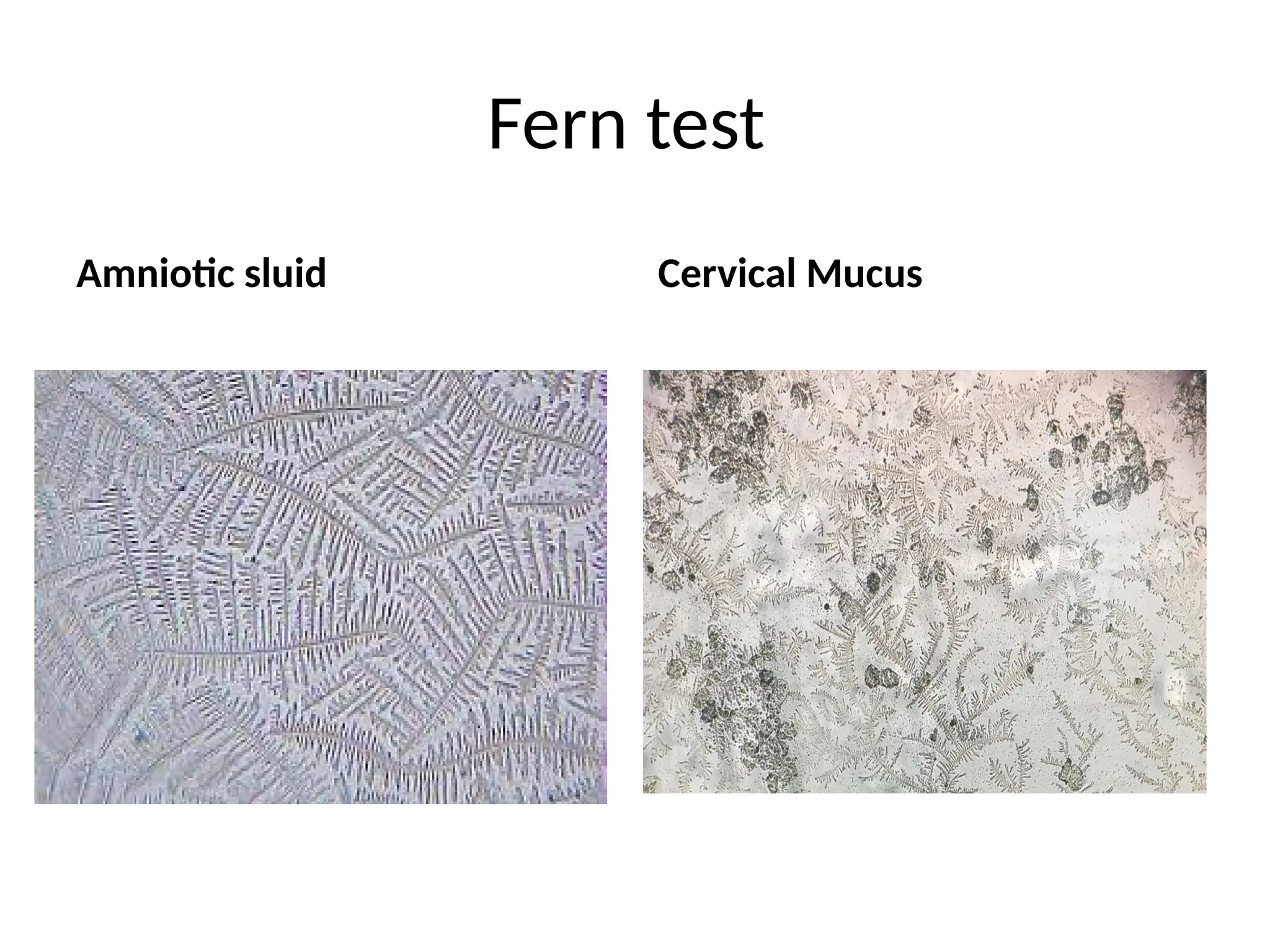 Premature Rupture of Membranes. - MBBS lecture pptx.pptx