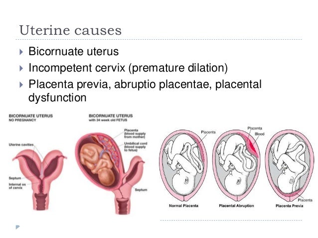 Placenta Uterus Pregnancy