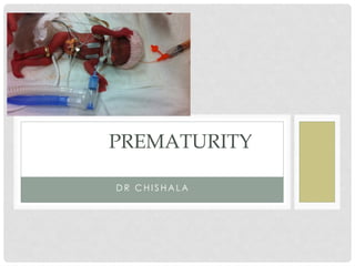 Prematurity - presentation final .pptx