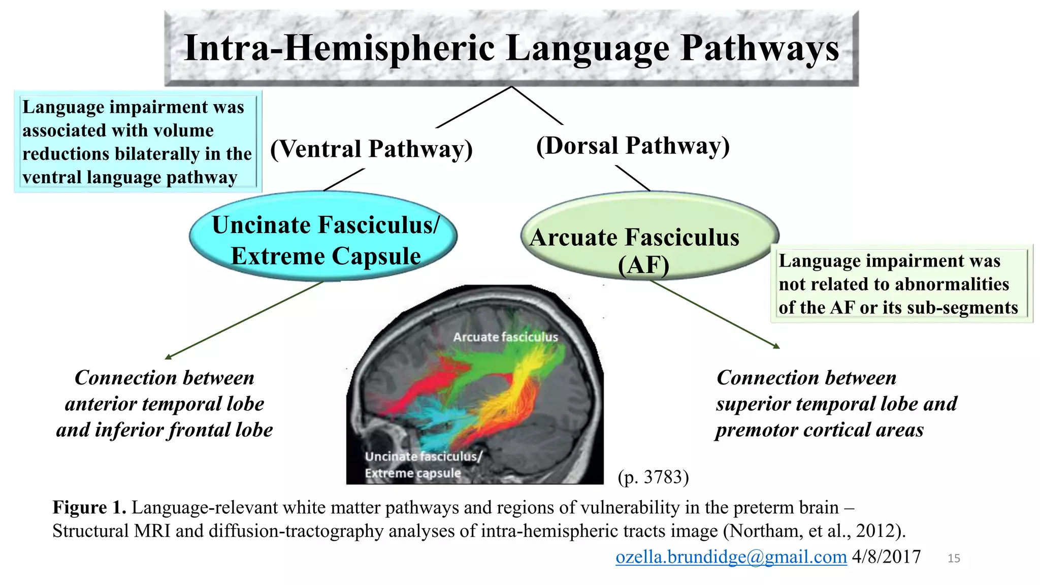 Prematurity Affects The Integrity Of The Dorsal And Ventral Streams Ppt