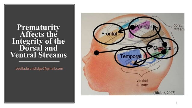 Prematurity affects the integrity of the dorsal and ventral streams | PPT
