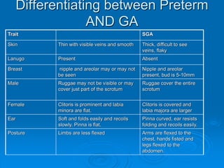 PREMATURITY NEONATOLOGY.PPT | Pregnancy | Reproductive Health