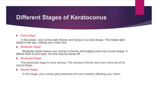 Premier Keratoconus Treatment in Mumbai. | PPT