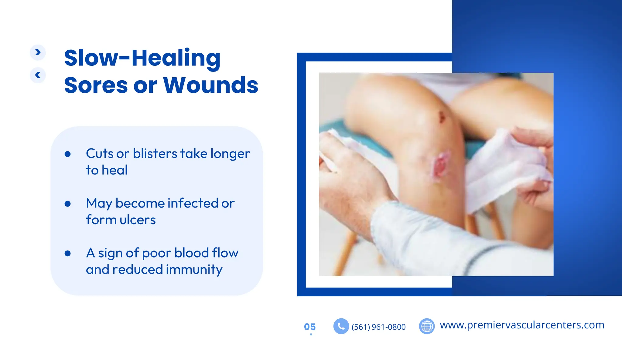 Warning Signs of Poor Circulation You Should Never Ignore | PDF