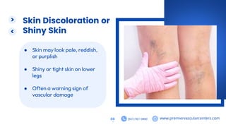 Warning Signs of Poor Circulation You Should Never Ignore | PDF